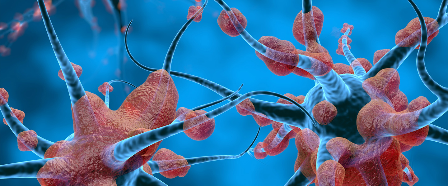 Neuro-Infectious Disease & Global Neurology: The Ken & Ruth Davee ...